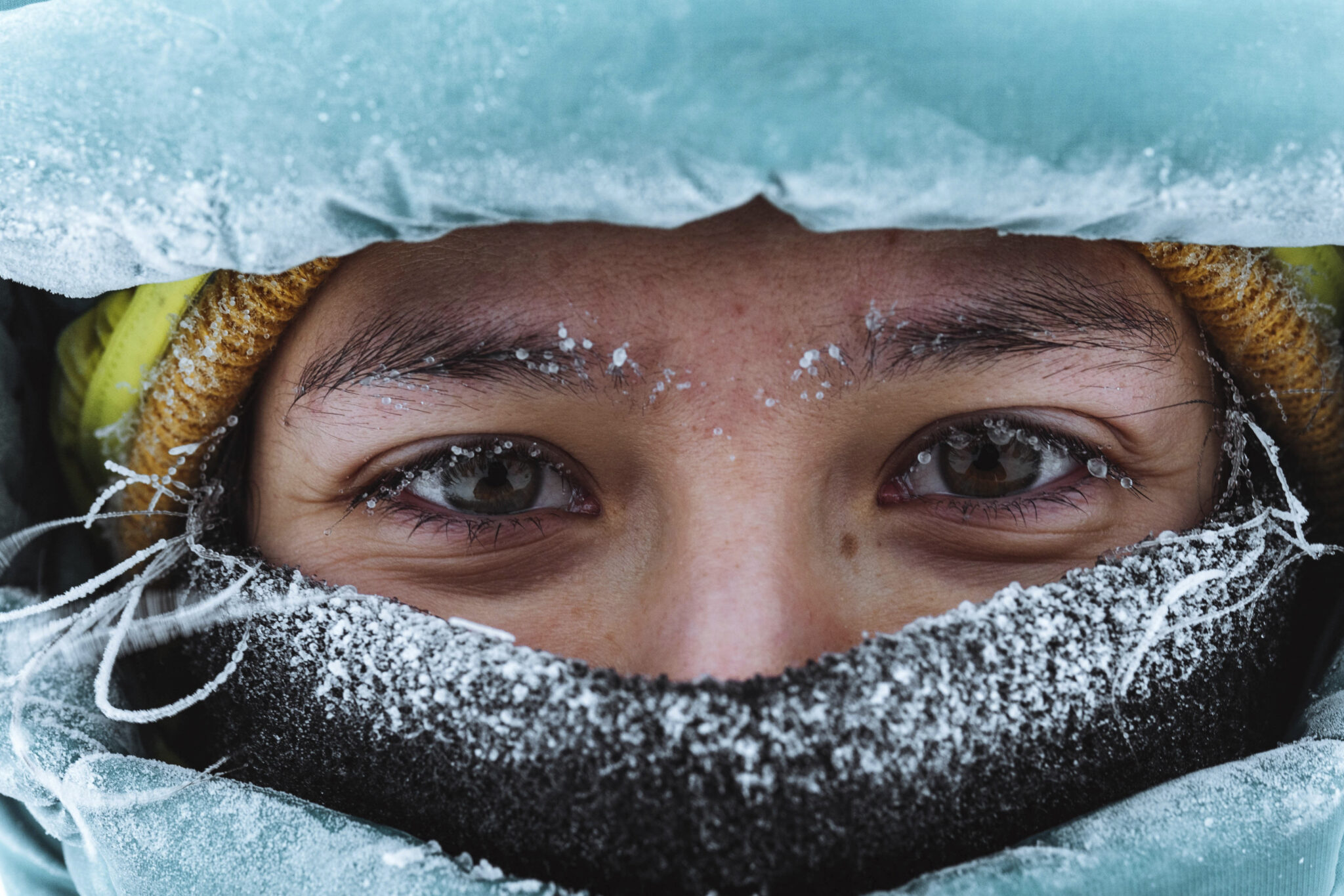 Ice Hack for Eyes Vision – TikTok Trend & Eye Health Benefits