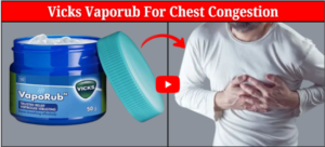 Vicks Vaporub For Chest Congestion: Relief Guide